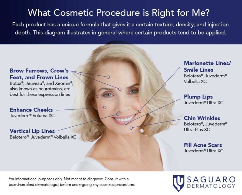 Dermal Fillers in Phoenix, AZ | Book Your Appointment Online